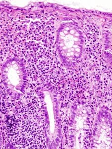 Large Intestinal Motility - Haustral Shuttling - Mass Movement ...