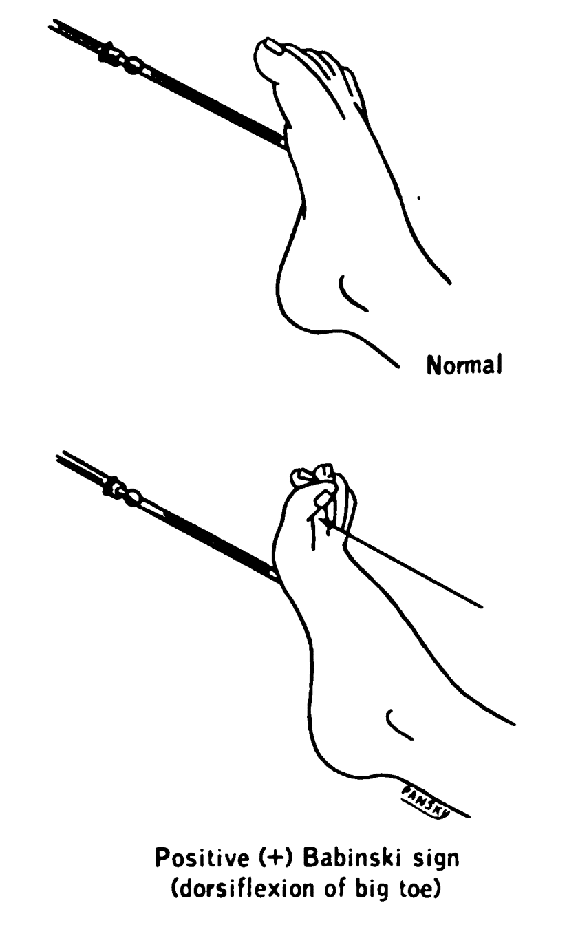 Upper Motor Neurones - TeachMePhysiology