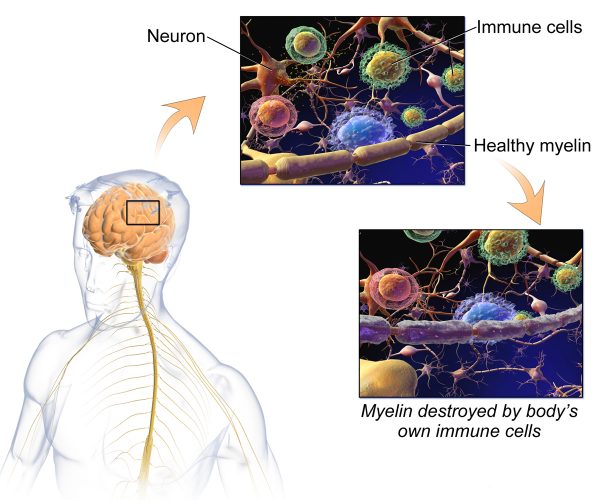 Central Nervous system - Structure - Function - TeachMePhysiology