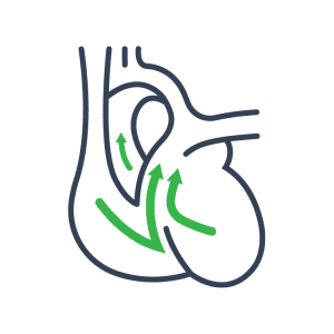 Cardiac Cycle - TeachMePhysiology