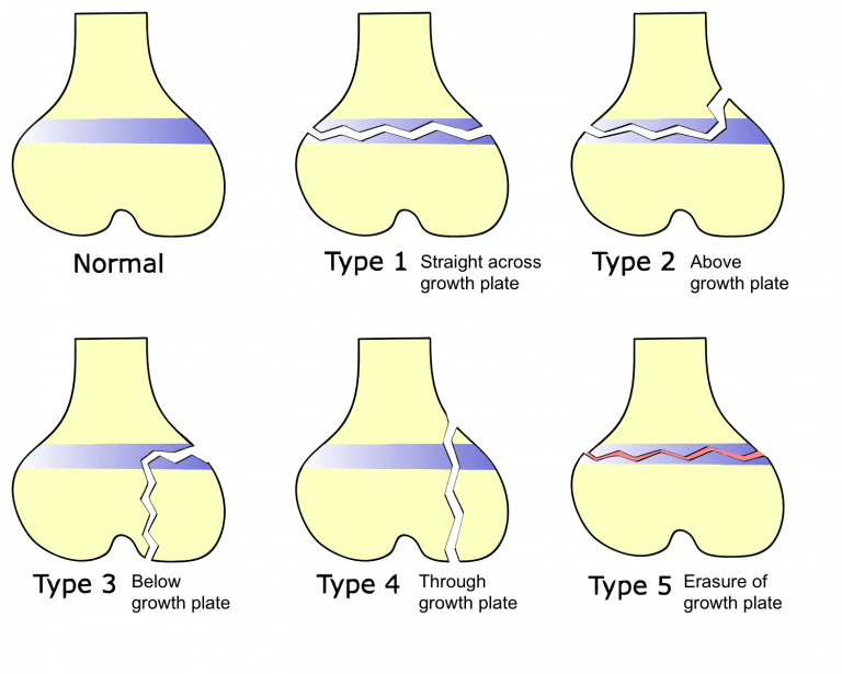 Ossification Process