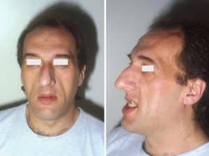 Growth Hormone - Actions - Regulation - TeachMephysiology