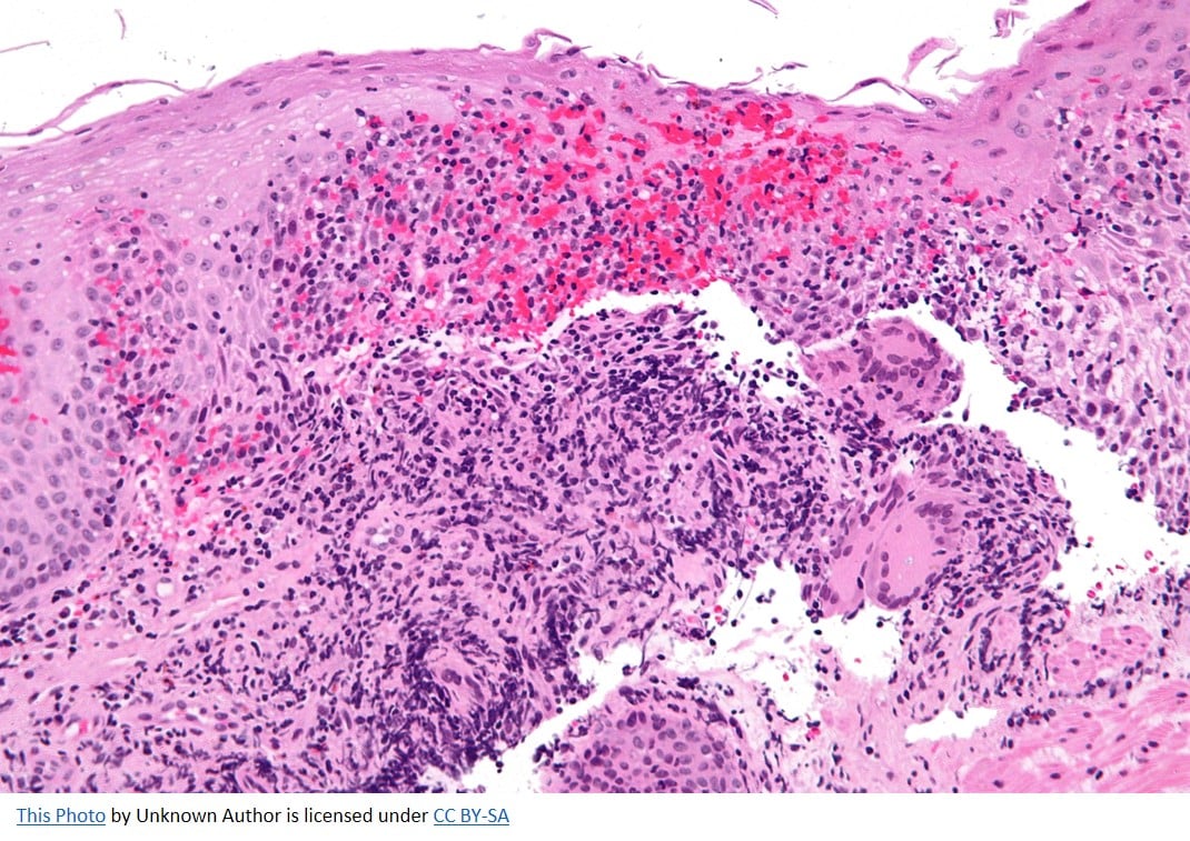 Large Intestinal Motility - Haustral Shuttling - Mass Movement ...