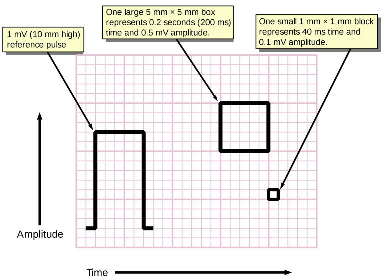 The ECG - EKG - ECG leads - Physiology - TeachMePhysiology