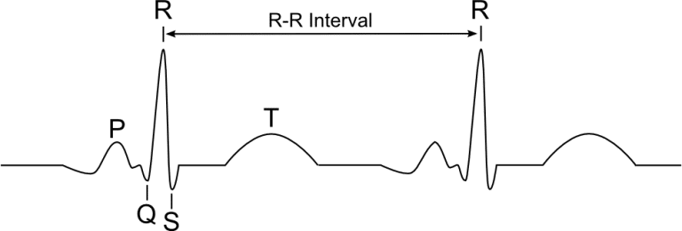 The ECG - EKG - ECG leads - Physiology - TeachMePhysiology