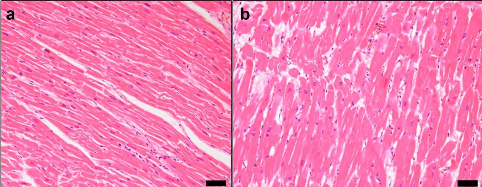Structure of Cardiac Muscle - Myopathy - TeachMePhysiology