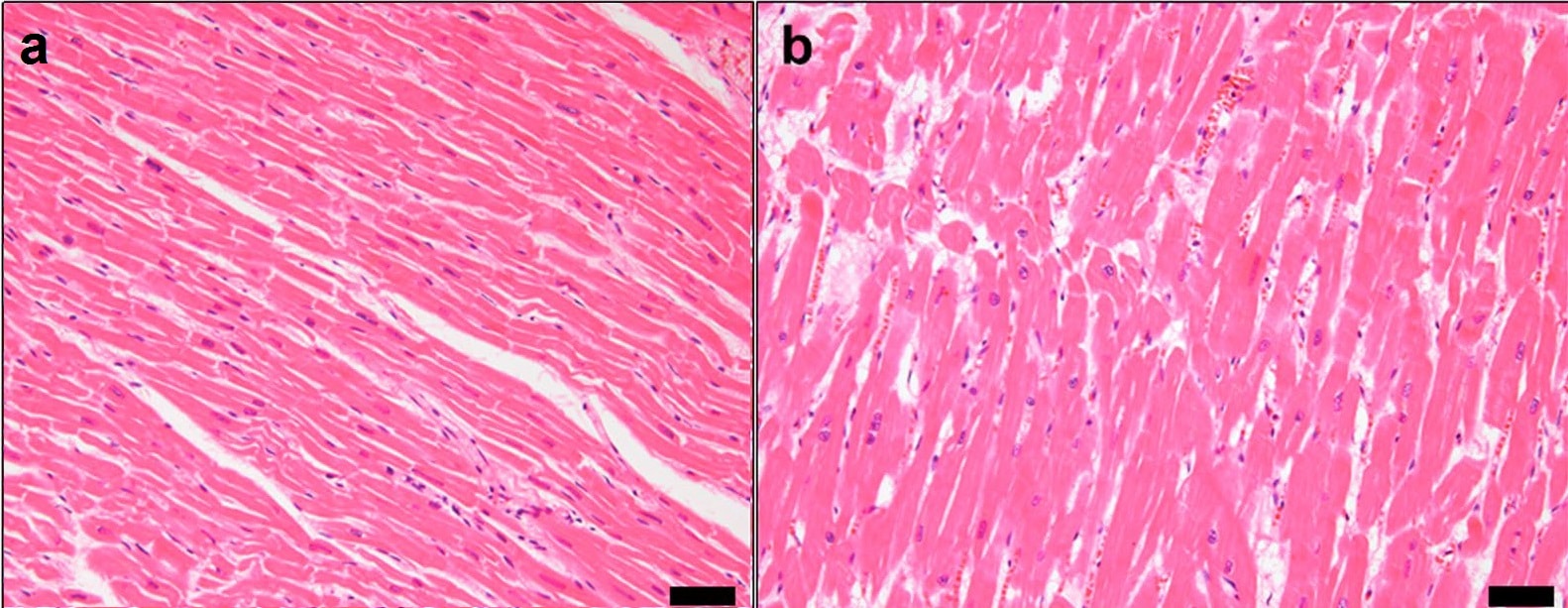 Structure of Cardiac Muscle - Myopathy - TeachMePhysiology