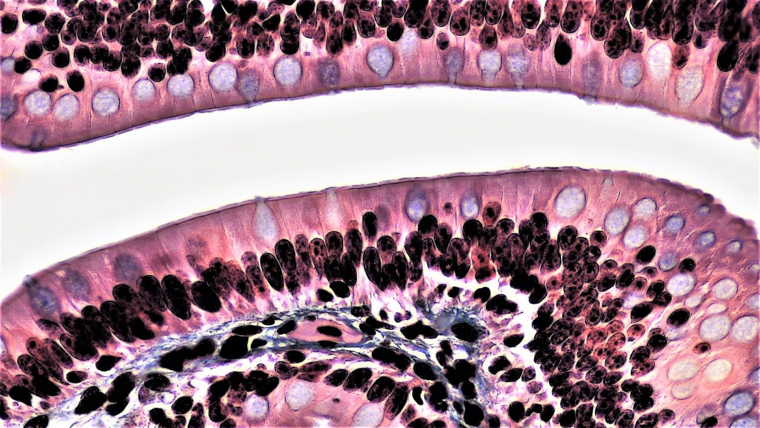 Epithelial Cells - Simple - Stratified - TeachMePhysiology