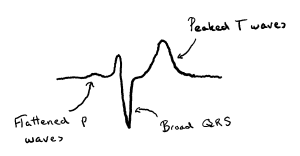 External Balance of Potassium - Regulation - TeachMePhysiology