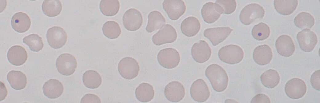 Function of The Spleen - White and Red Pulp - TeachMePhysiology